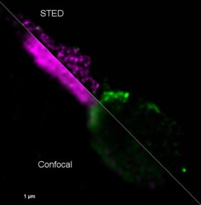 Cell Imaging - Institut Toulousain des Maladies Infectieuses et ...